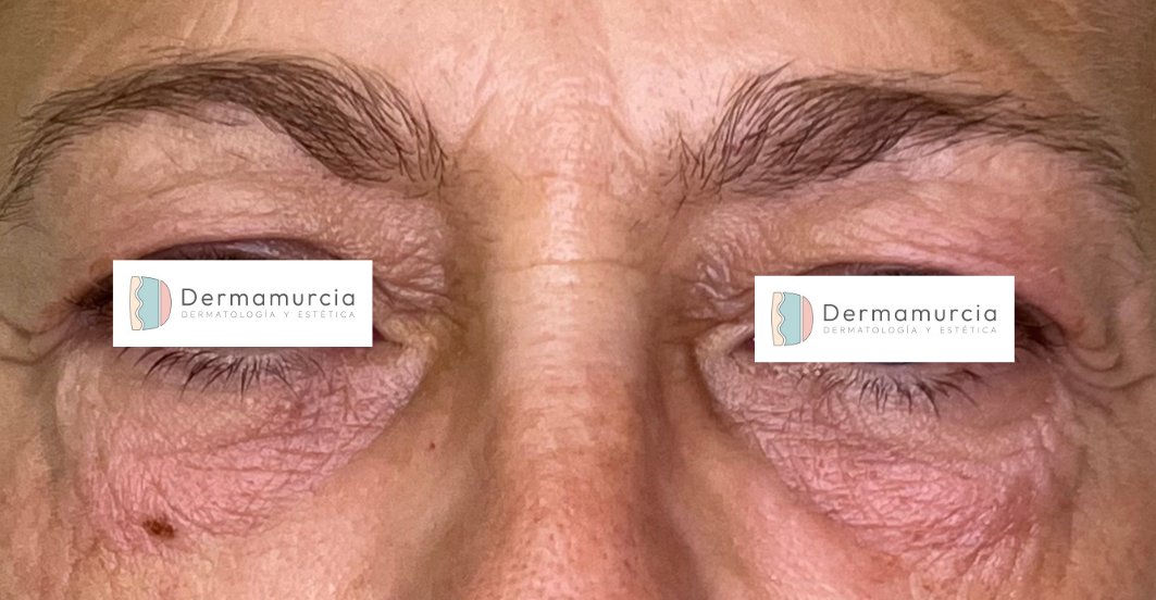 Contorno de ojos: problemas y soluciones